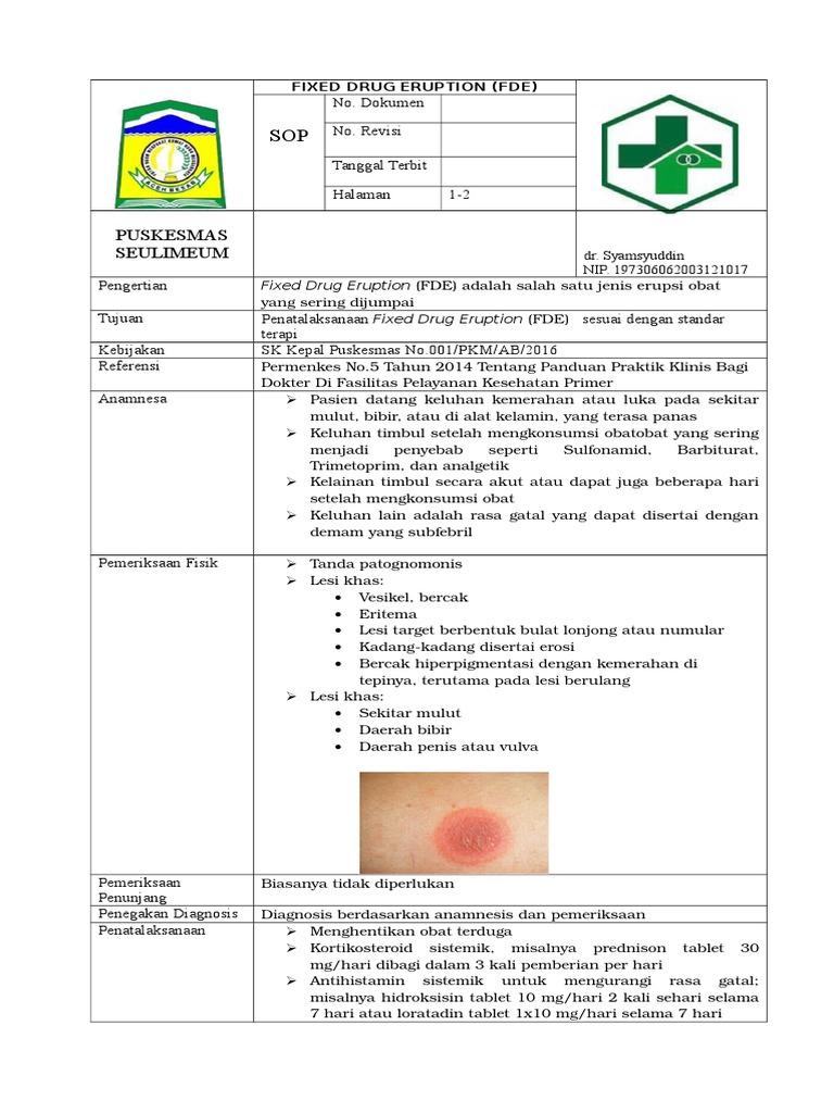 Fixed Drug Eruption (Fde) | PDF