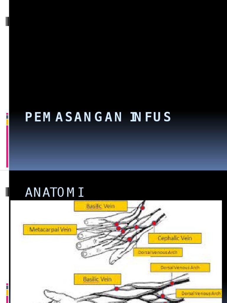 Pemasangan Infus | PDF