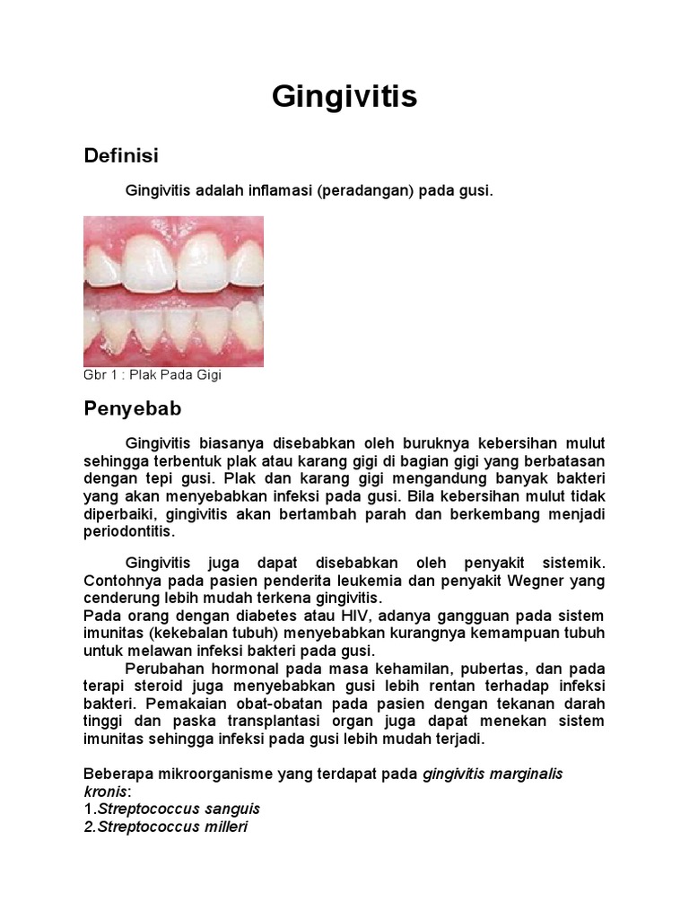 Gingivitis | PDF