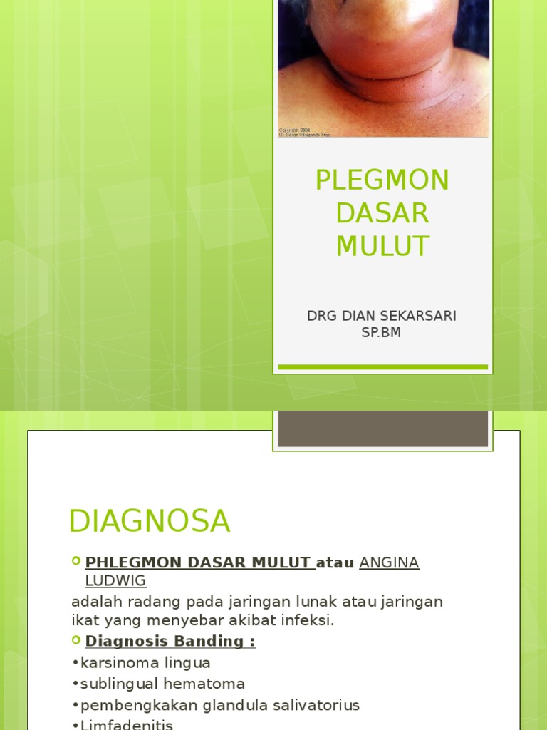 Phlegmon Dasar Mulut: Diagnosis dan Penanganan | PDF | Pengembangan ...