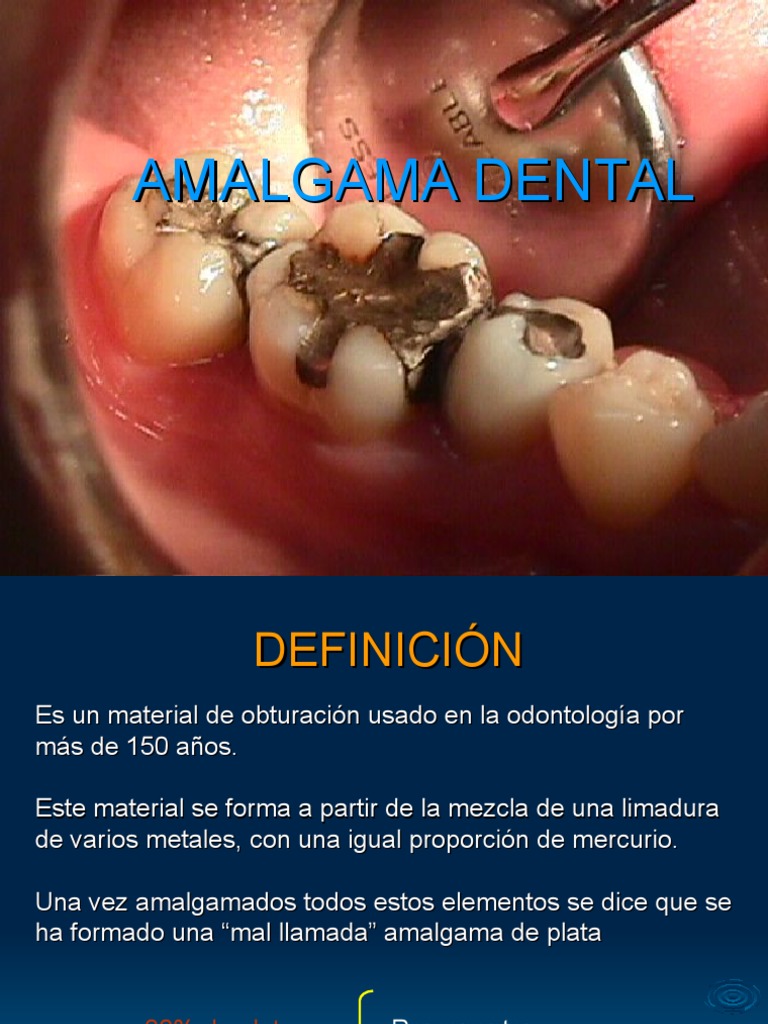 Amalgamas | Mercurio (Elemento) | Estaño