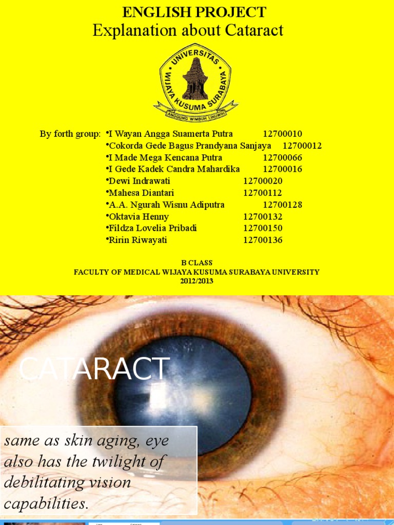 Cataract | PDF | Cataract | Diseases And Disorders
