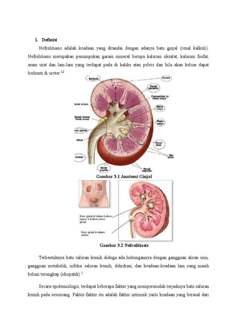 Nefrolitiasis Dan Hidronefrosis | PDF