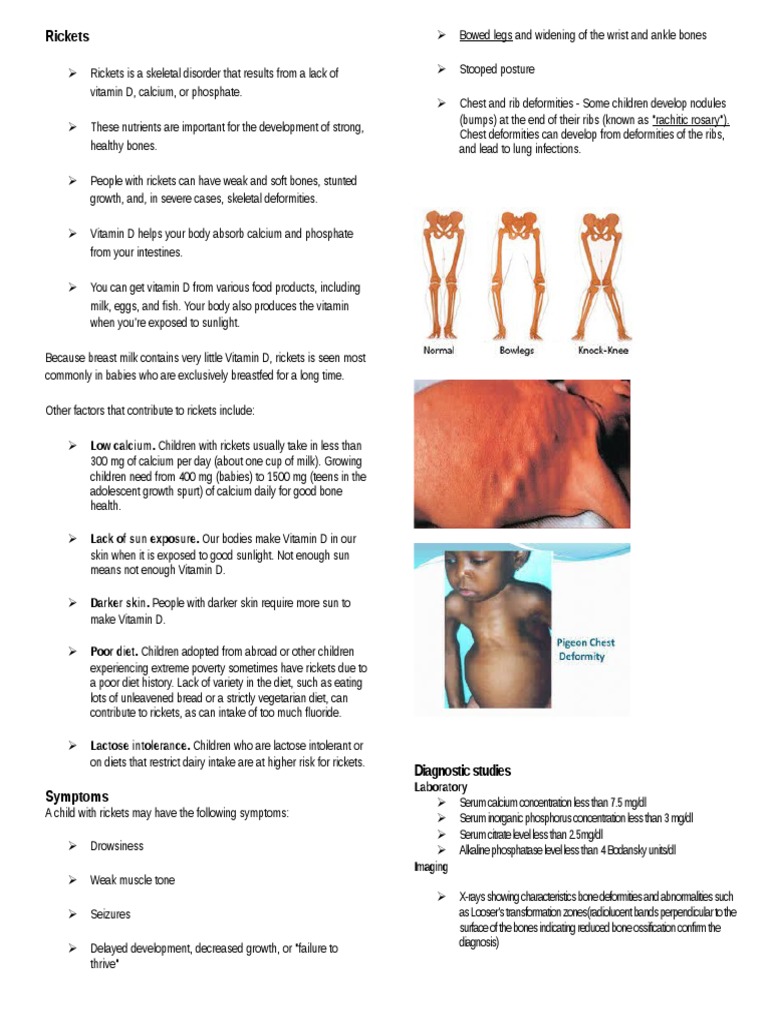 The Skeletal and Systemic Effects of Rickets: Causes, Symptoms ...