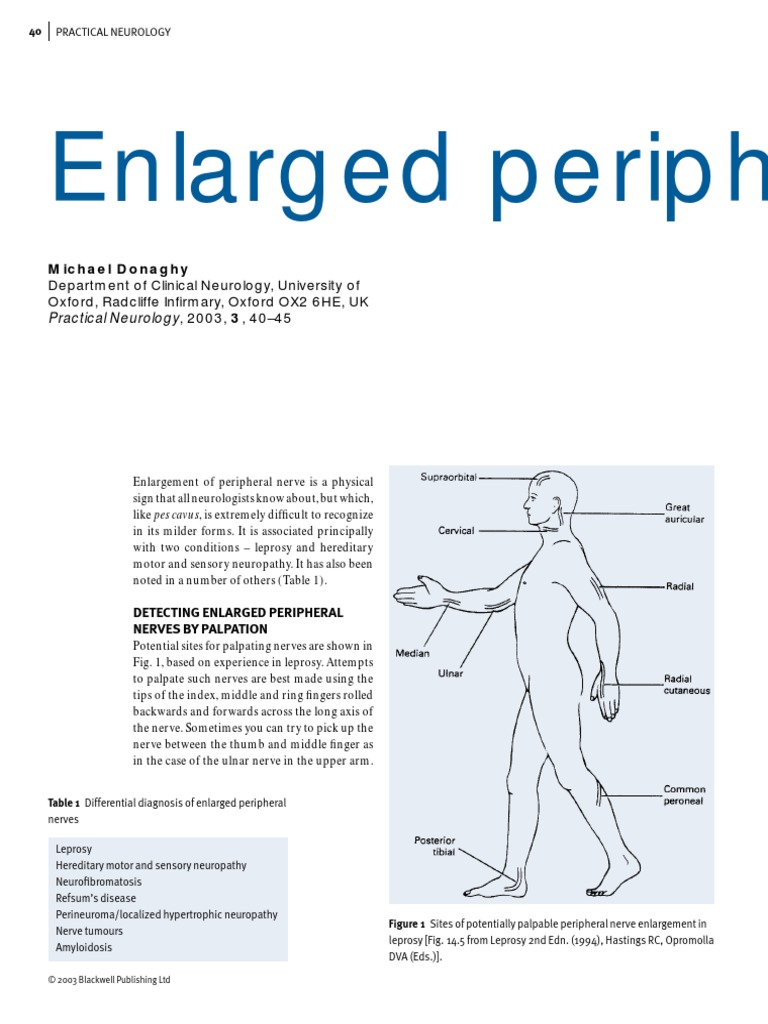Enlarged Peripheral Nerves on Leprosy | Peripheral Neuropathy | Leprosy