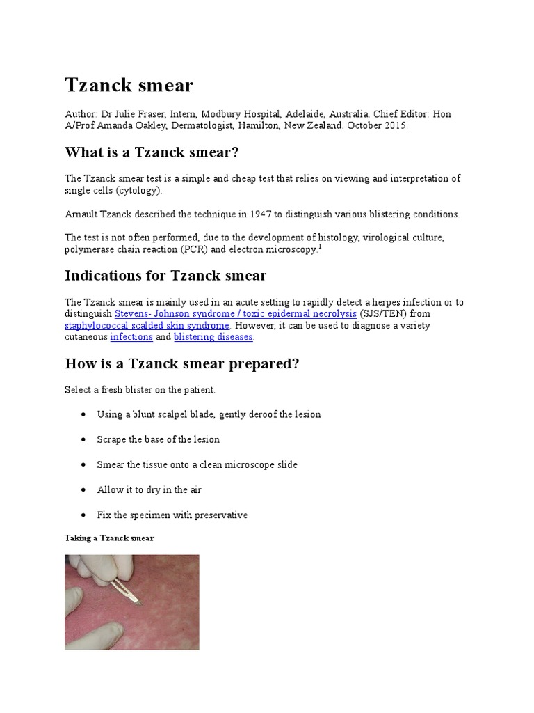 What Is A Tzanck Smear? | PDF | Staining | Cytopathology