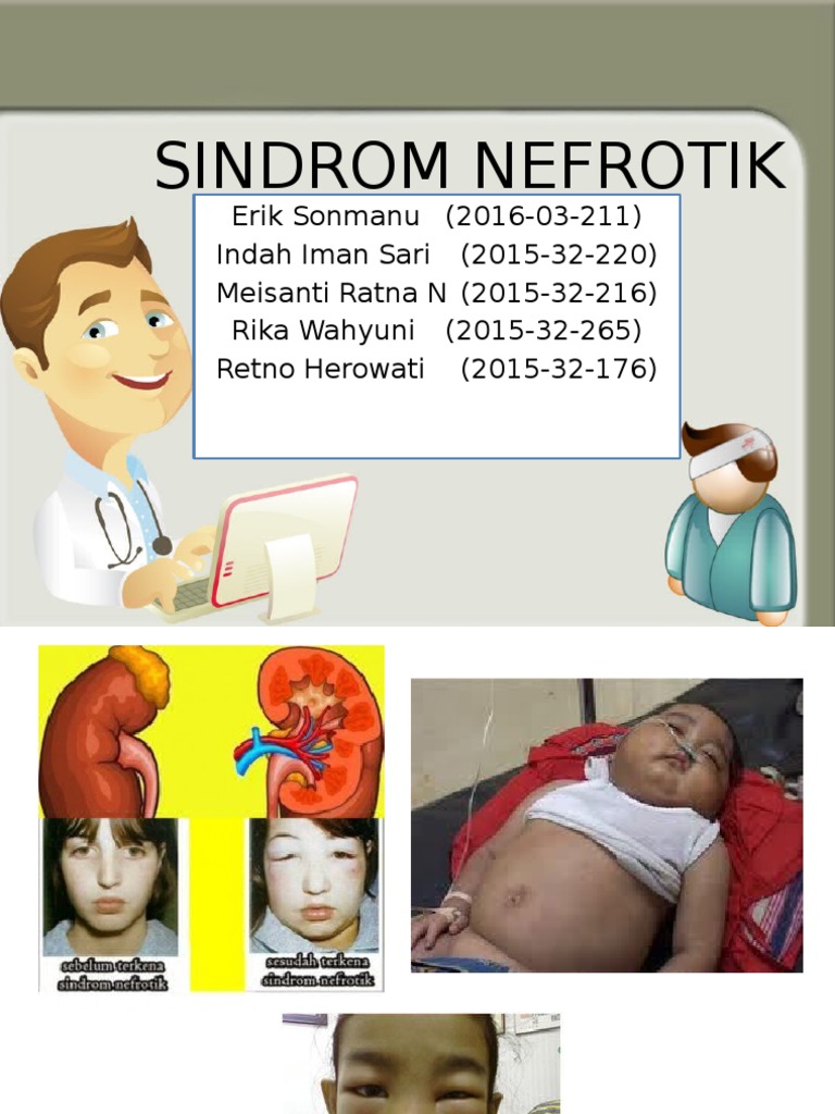 Kelompok 2 PPT Sindrom Nefrotik | PDF