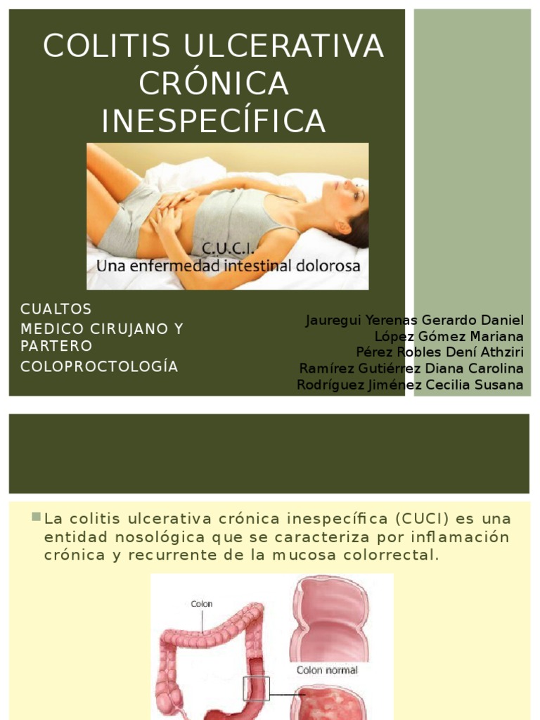 Colitis Ulcerativa Crónica Inespecífica | Medicina CLINICA | Medicina