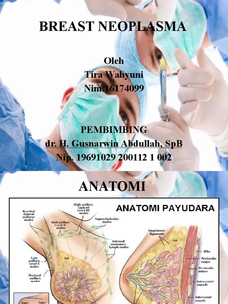 Breast Neoplasma | PDF