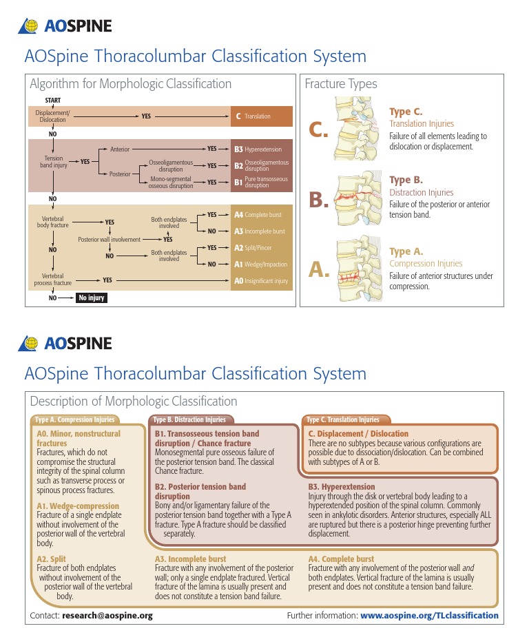 AOSpine Thoracolumbar Classification System - Pocket Card | PDF ...