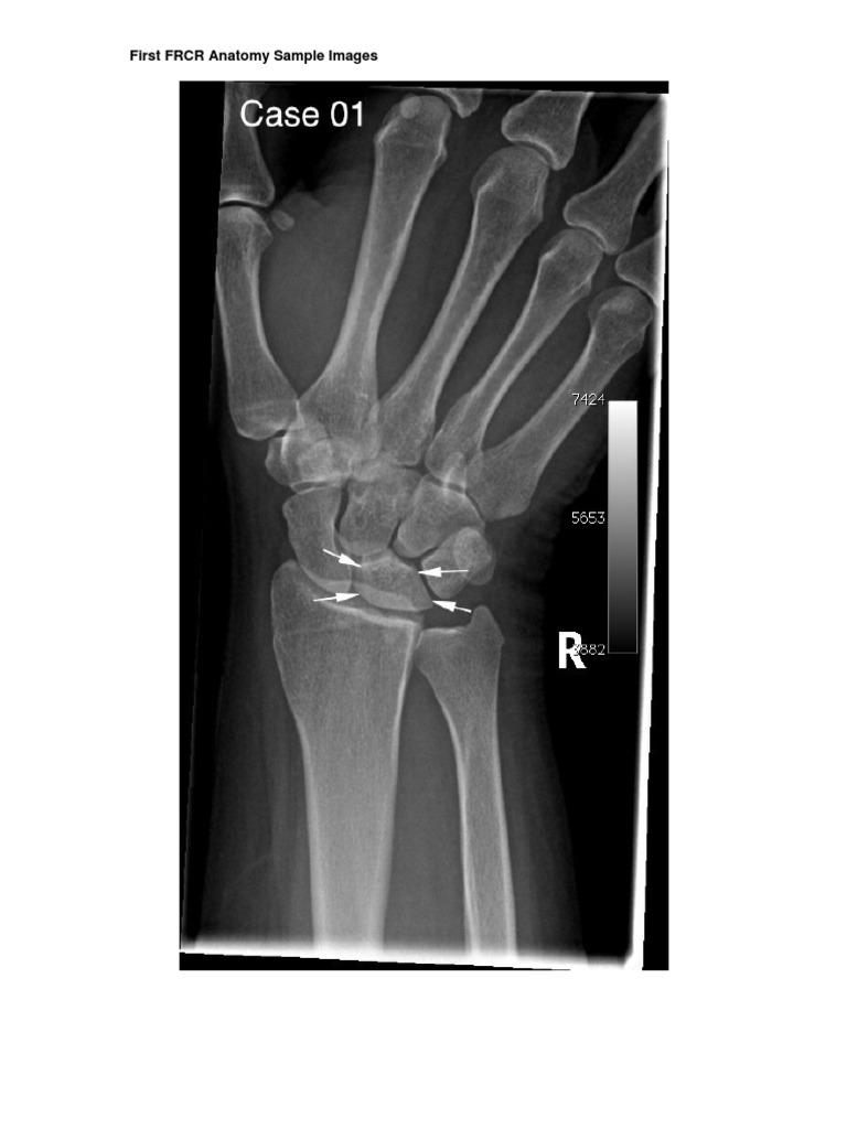 Cr1 Anatomy Sample Images | PDF