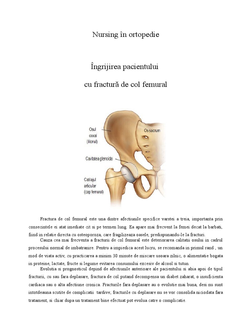Fractura de Col Femural | PDF