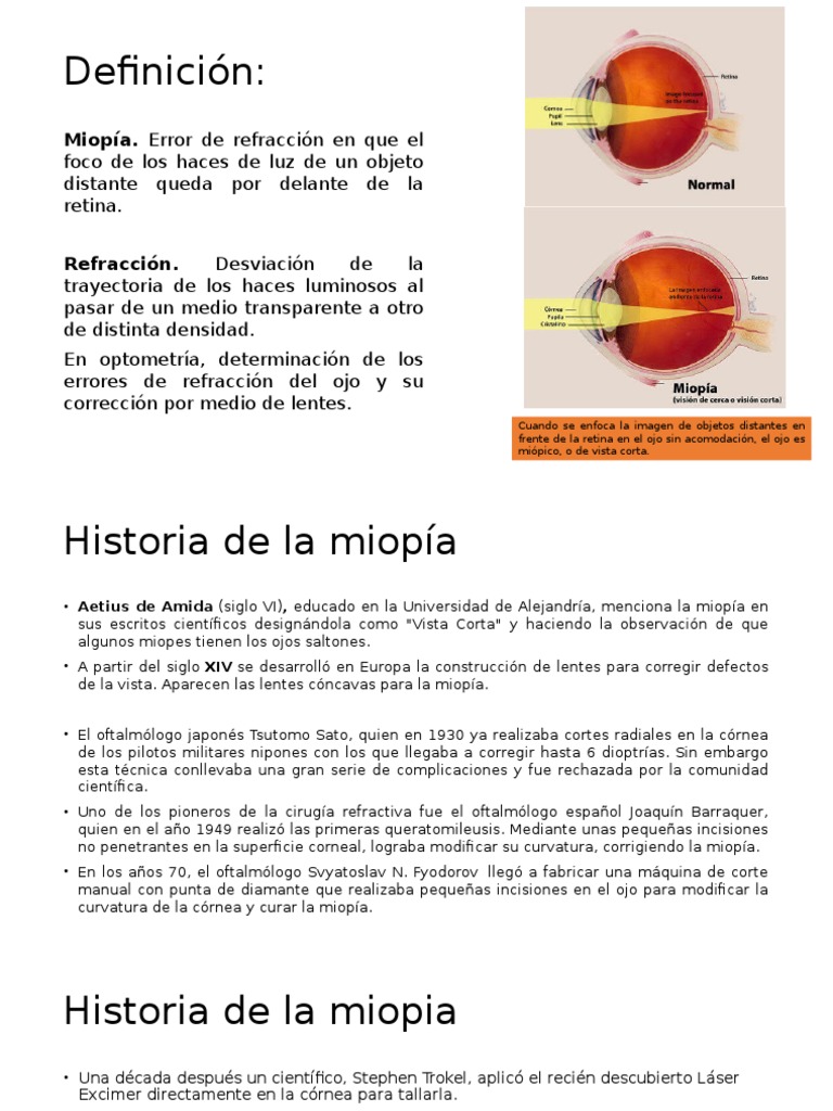 Leve descripcion de la miopia