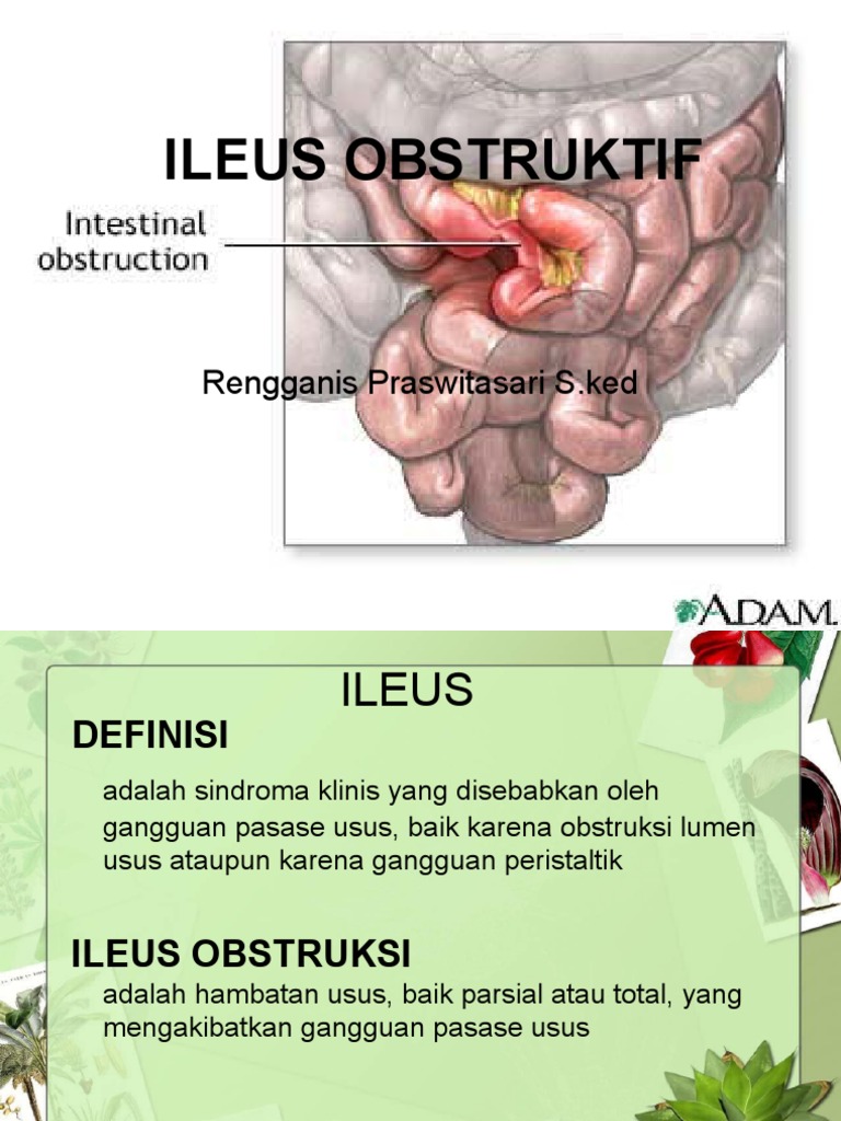 Pemahaman tentang Ileus Obstruktif | PDF | Pengembangan Diri