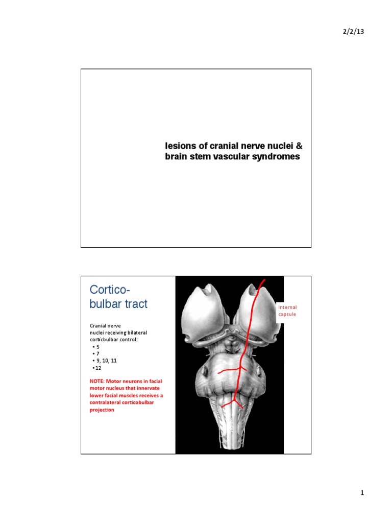 Cortico-Bulbar Tract": Lesions of Cranial Nerve Nuclei & Brain Stem ...