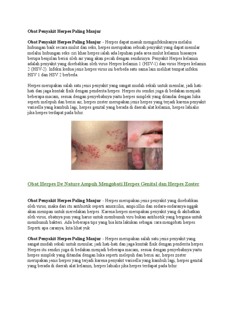 Obat Penyakit Herpes Paling Manjur | PDF