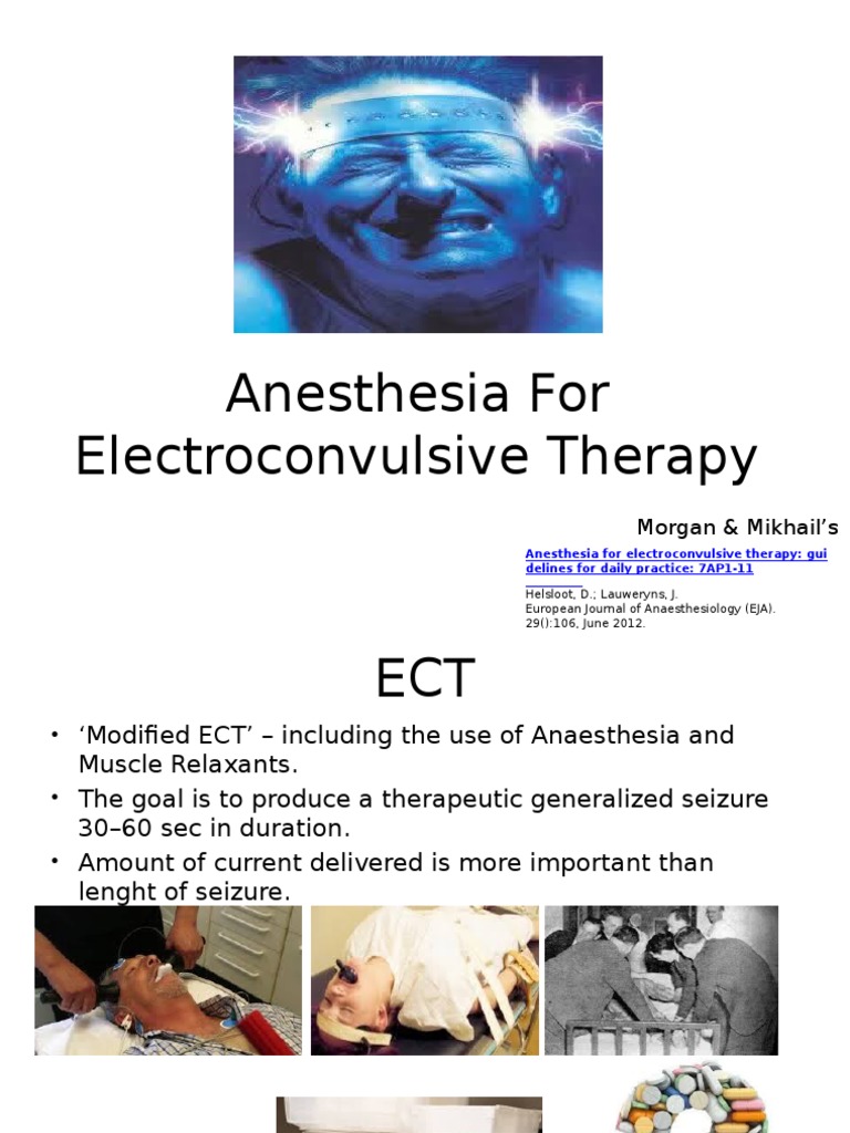 Anesthesia For Electroconvulsive Therapy - Ujo | PDF ...