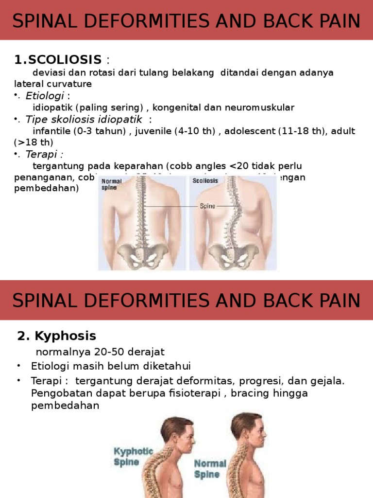 Spinal Deformities and Back Pain | PDF