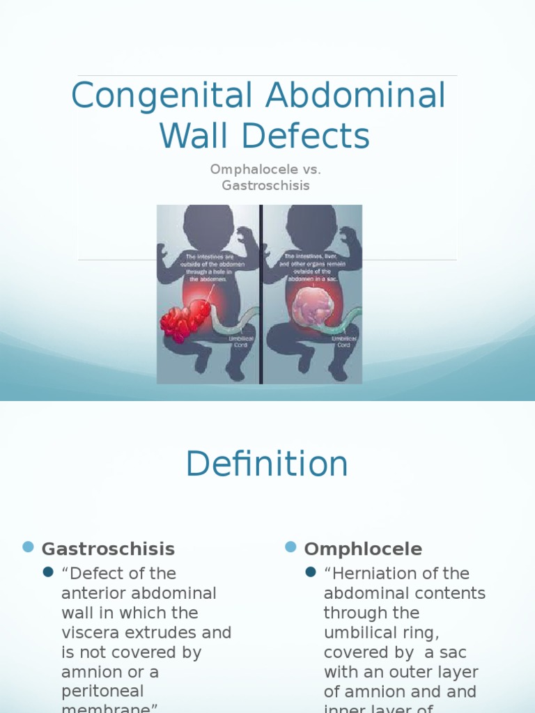 Abdominal Wall Defects | PDF | Medicine | Medical Specialties