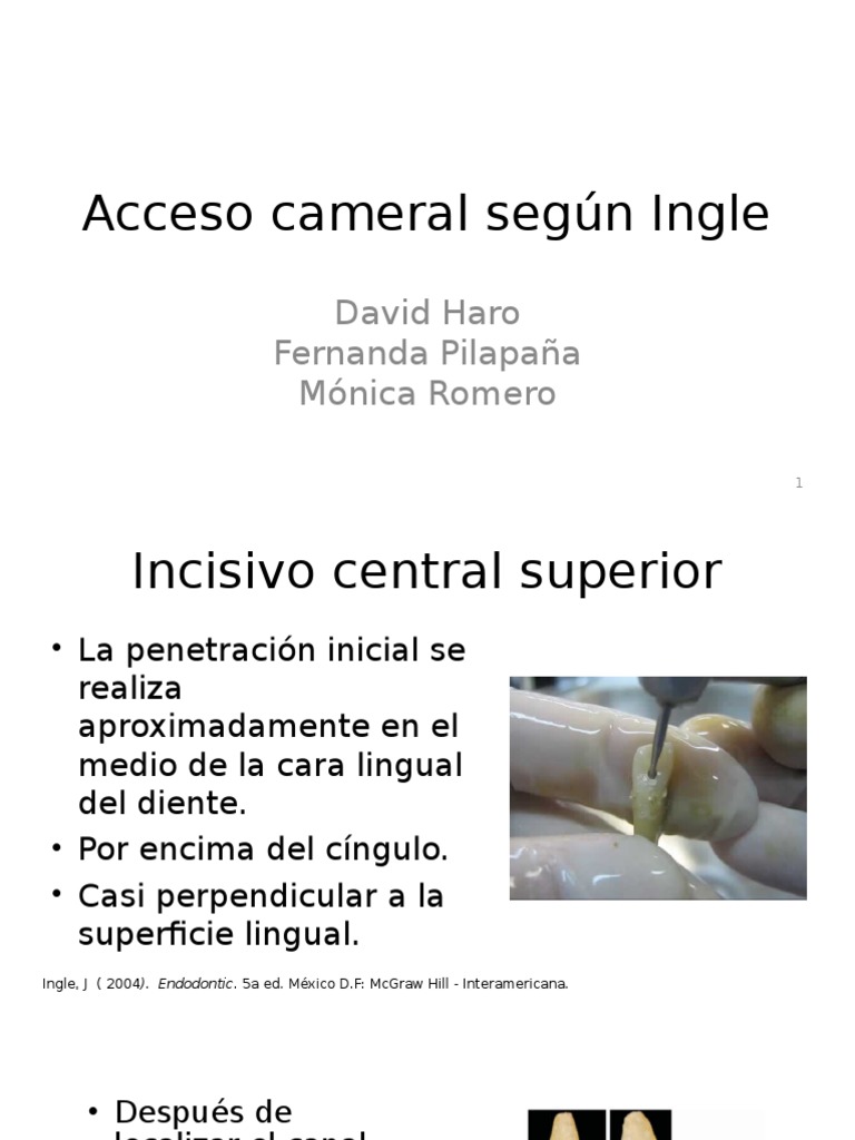 Acceso Cameral | PDF | Anatomia dental | Boca