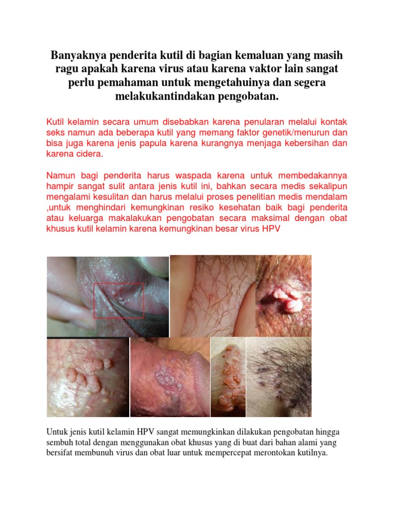 Gambar Kutil Kelamin Yang Berbahaya | PDF | Kesehatan Holistik | Gaya Hidup