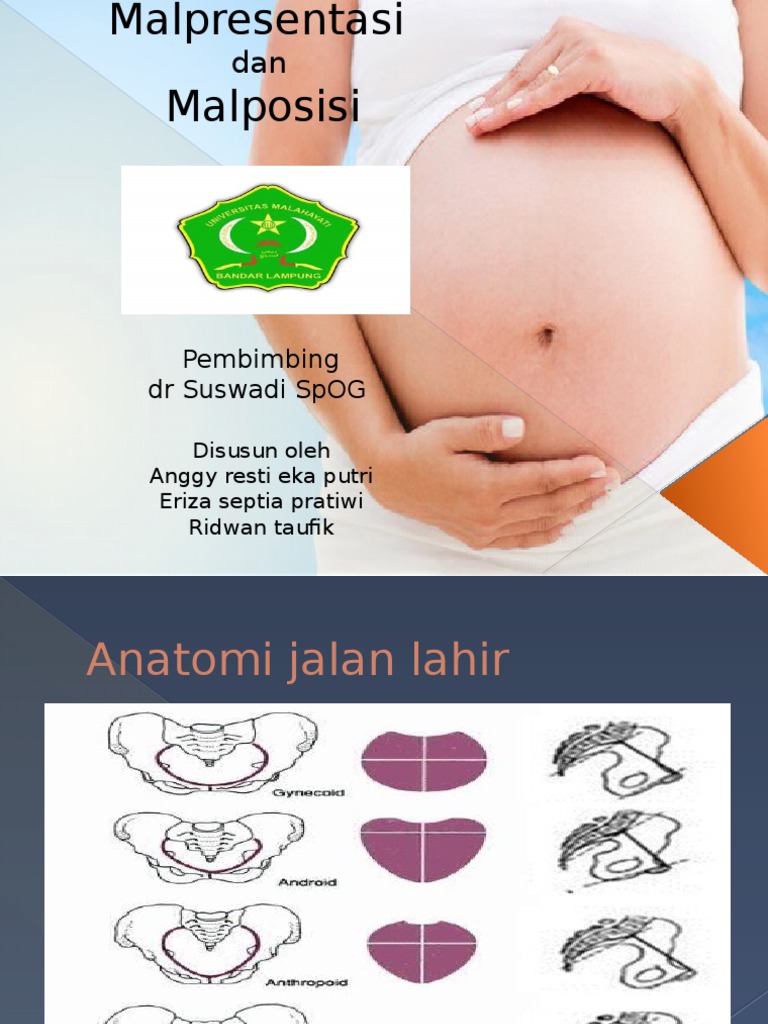 Malposisi Dan Malpresentasi | PDF