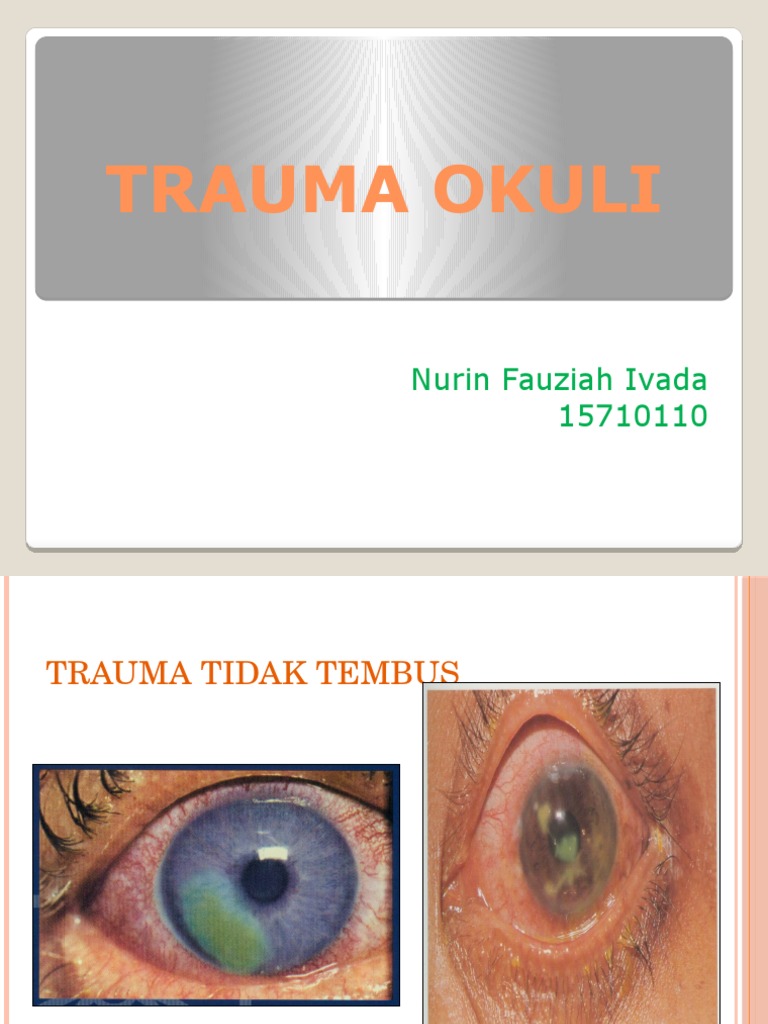 Trauma Okuli Nurin | PDF | Ophthalmology | Diseases Of The Eye And Adnexa