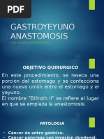 Técnicas Quirúrgicas: Hartmann y Miles | PDF | Cáncer colonrectal | Cirugía