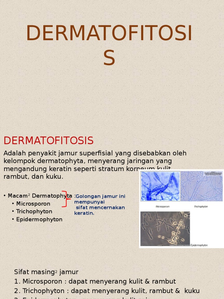 Penyakit Jamur Dermatofitosis dan Terapi | PDF | Sains & Matematika