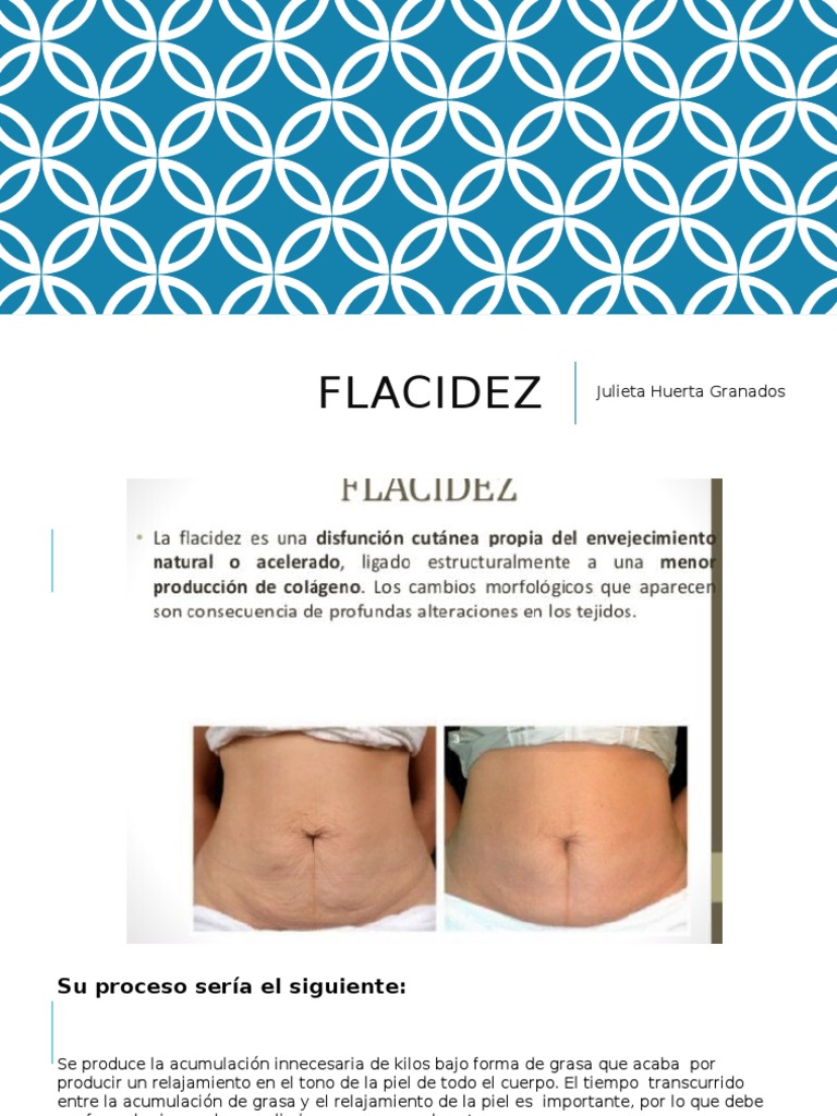 Flacidez | PDF | Piel | Tejido adiposo