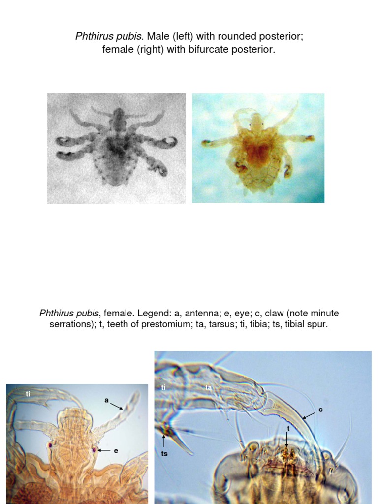 Phthirus Pubis. Male (Left) With Rounded Posterior | PDF