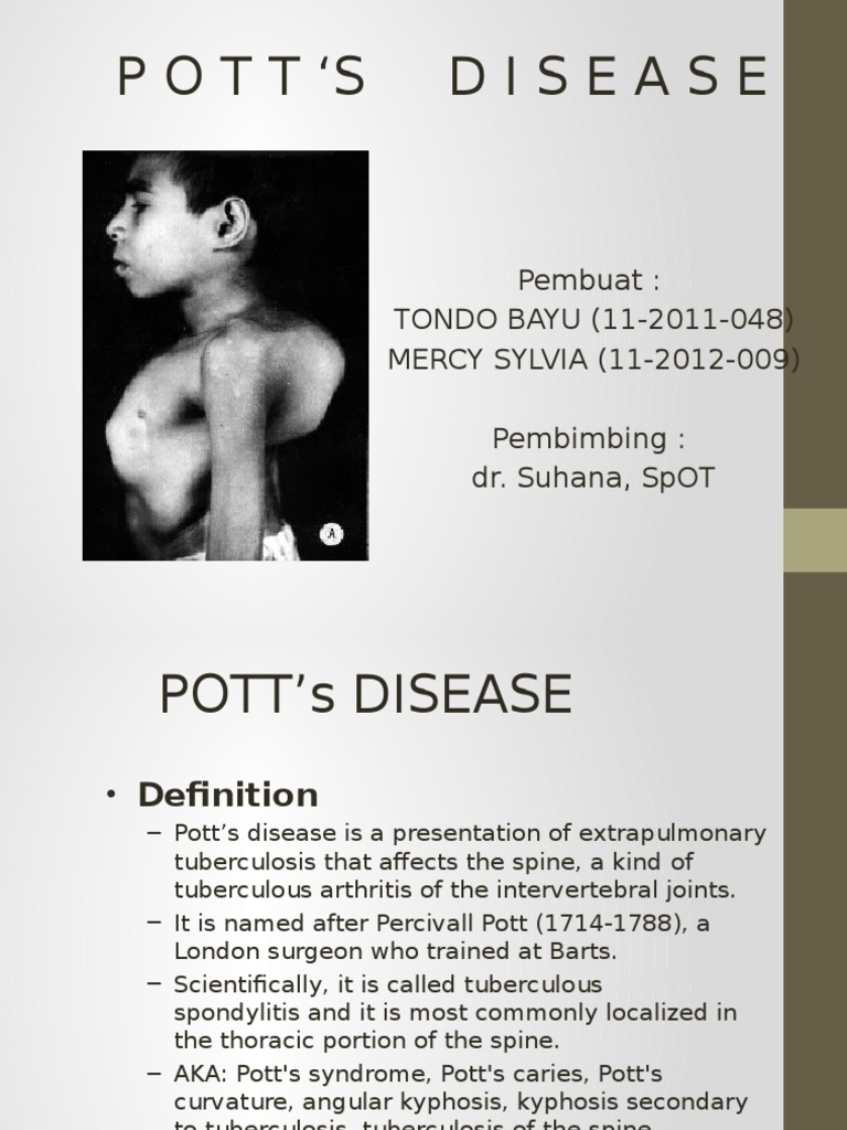 Spondilitis TB | PDF | Tuberculosis | Vertebral Column