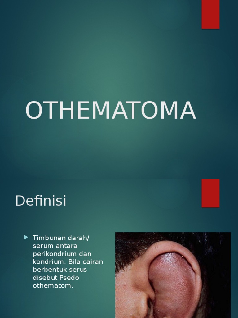 Othematoma | PDF