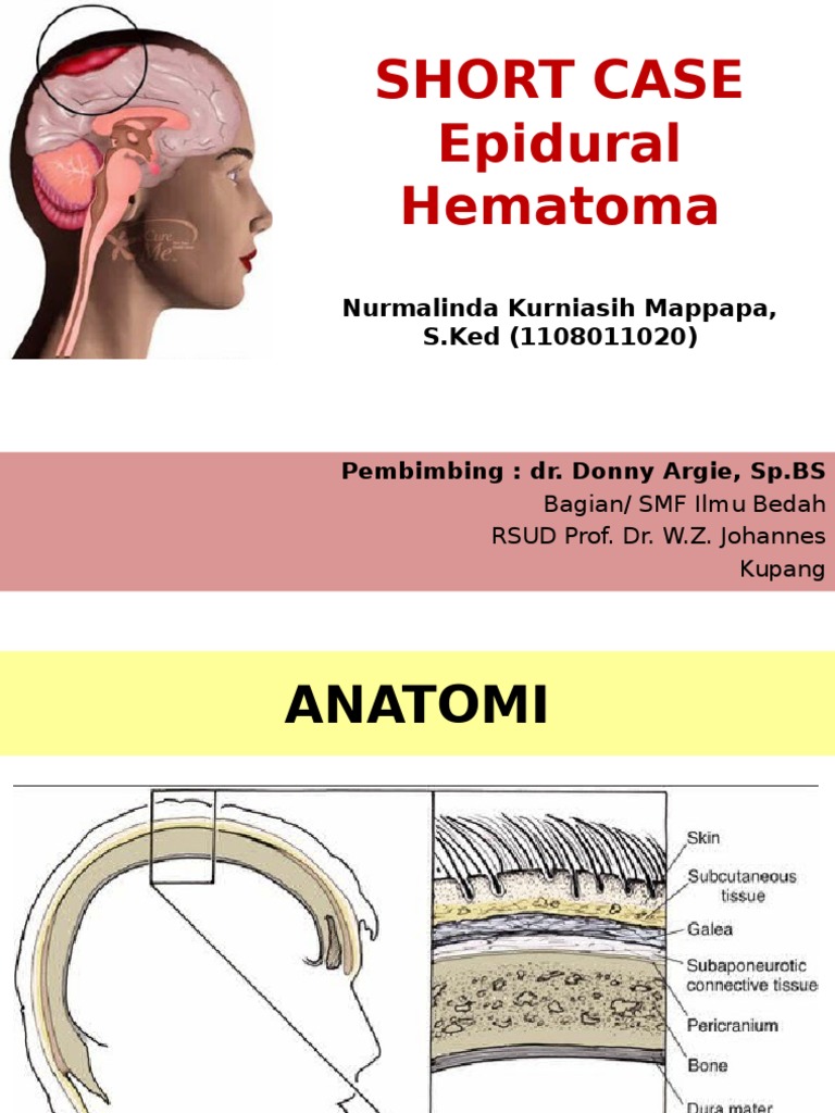 Epidural Hematoma Case Study Analysis | PDF | Traumatic Brain Injury ...