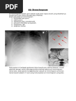 Anatomi Thorax Normal + Gambaran Radiologi | PDF