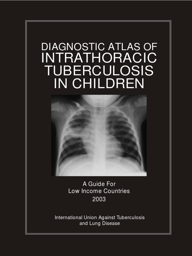 Iuatld Chesttb Atlas Kids PDF | PDF | Tuberculosis | Pneumonia