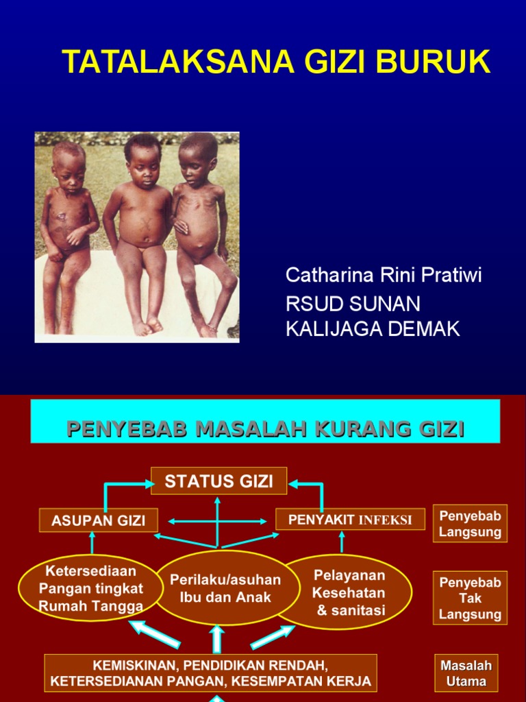 Tatalaksana Gizi Buruk | PDF