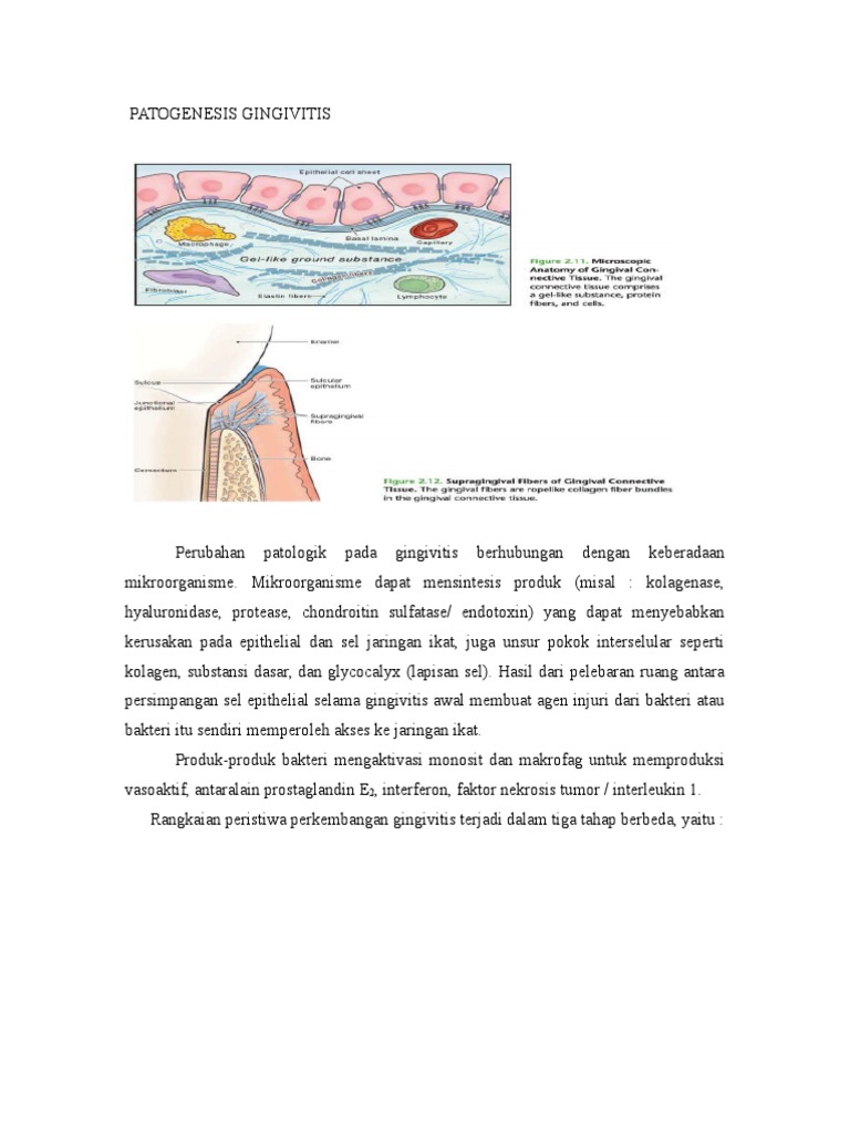 Patogenesis Gingivitis | PDF