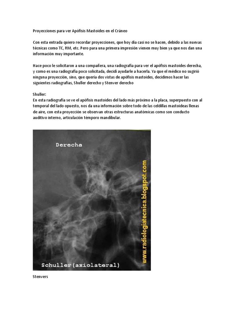 Metodo de Mastoides | PDF