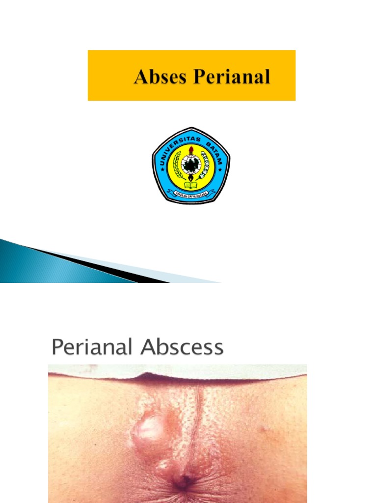 Abses Perianal | PDF | Sains & Matematika