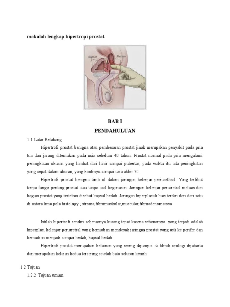 Makalah Hipertrofi Prostat Jinak | PDF | Pengembangan Diri | Kesehatan ...