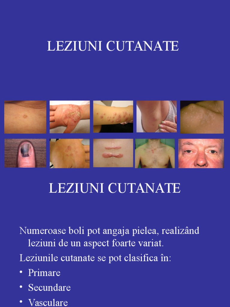 Leziuni Cutanate | PDF