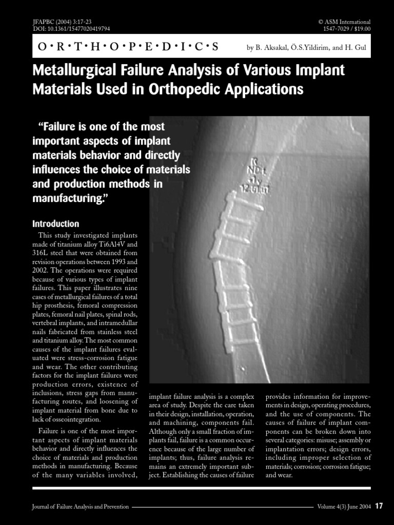 Metallurgical Failure Analysis of Various Implant | PDF | Dental ...