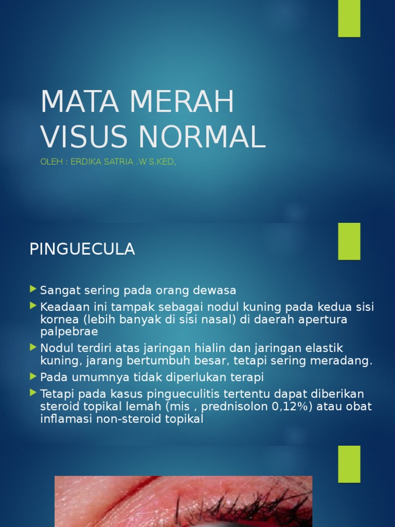 Mata Merah Visus Normal | PDF