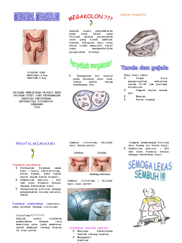 Leaflet Megacolon | PDF