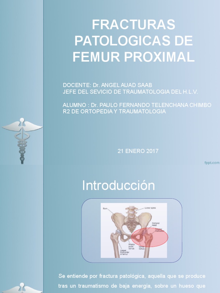 Fracturas Patologicas | PDF | Sarcoma | Traumatologia