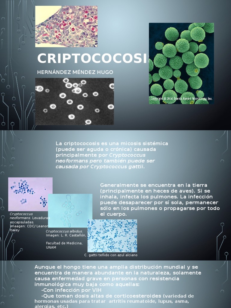 Criptococosis | PDF | VIH / SIDA | Rtt