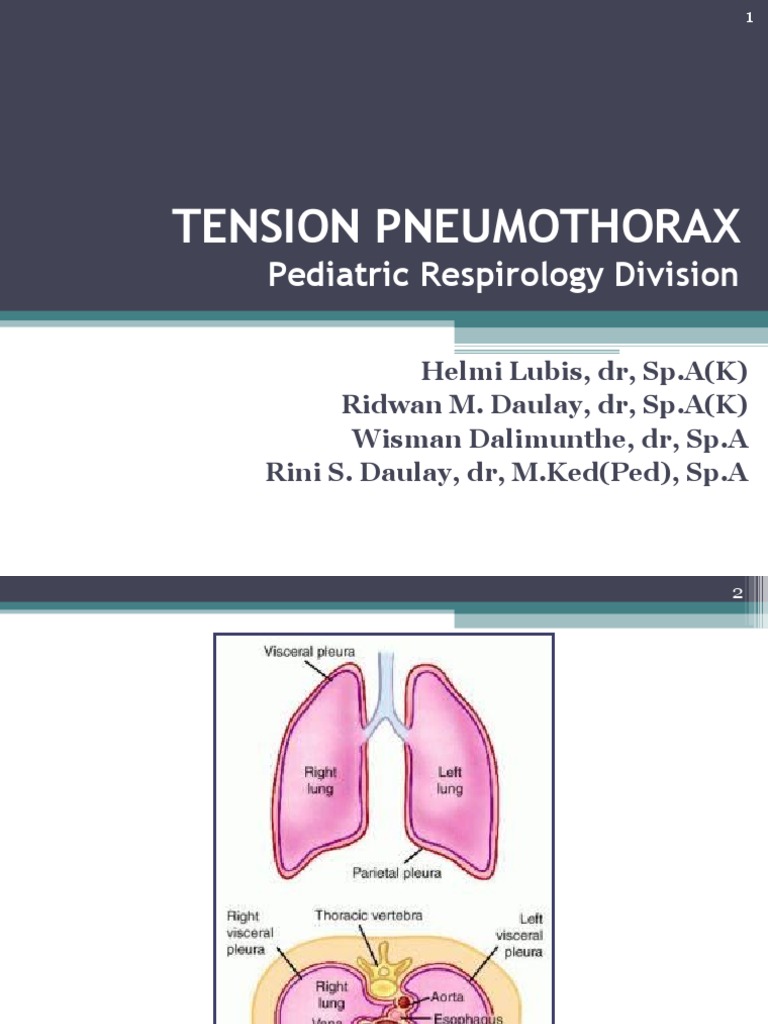 Understanding Tension Pneumothorax | PDF | Lung | Respiratory System