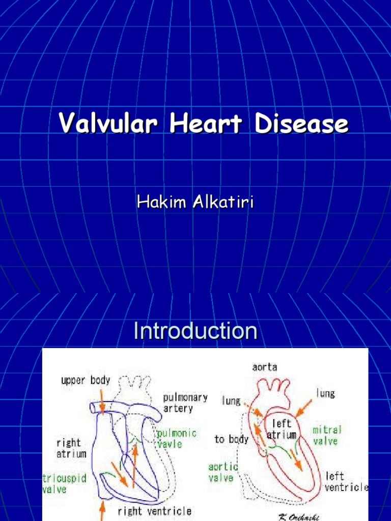 VHD Inter Final | PDF | Heart Failure | Heart Valve