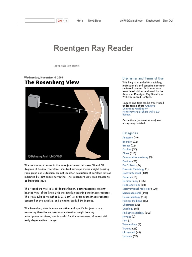 Rosenberg View | Radiology | Musculoskeletal System